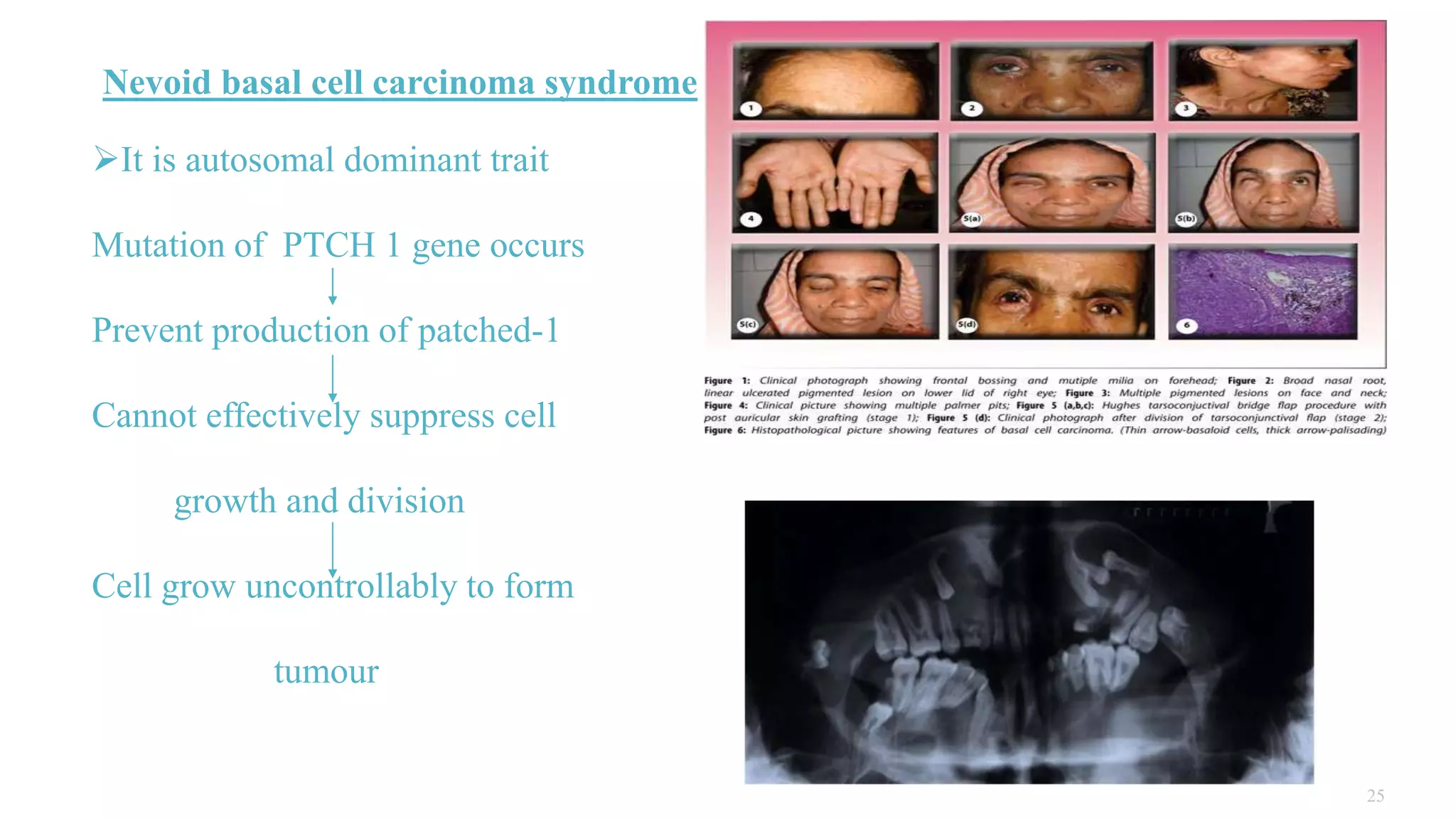 Oral health and genetics | PPTX