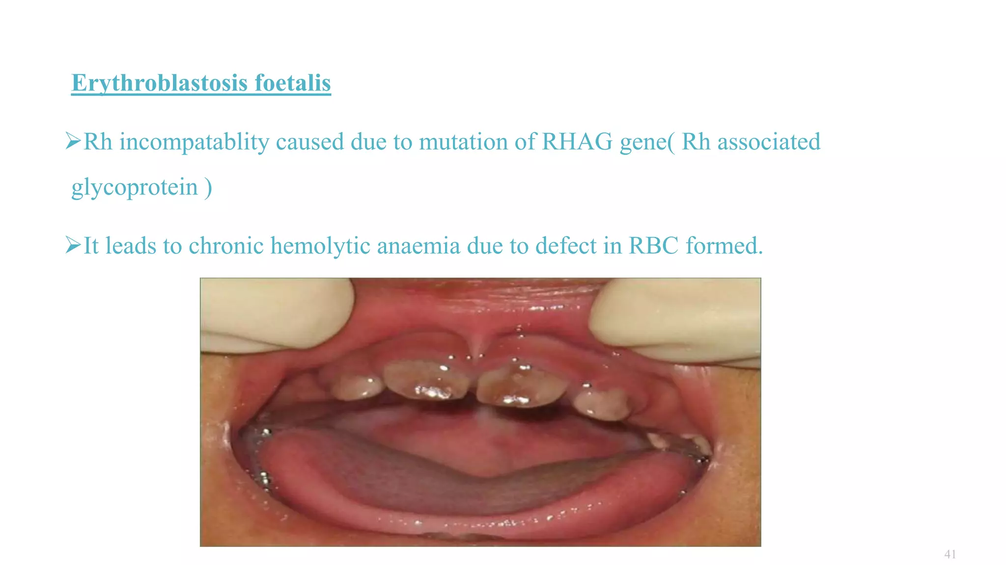Oral health and genetics | PPTX