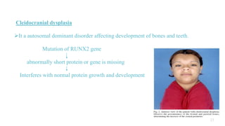 Oral health and genetics | PPTX