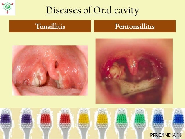 Oral health care
