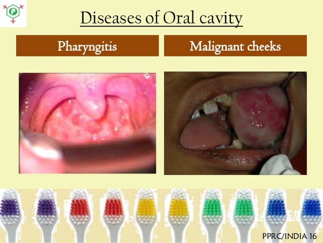 Oral health care