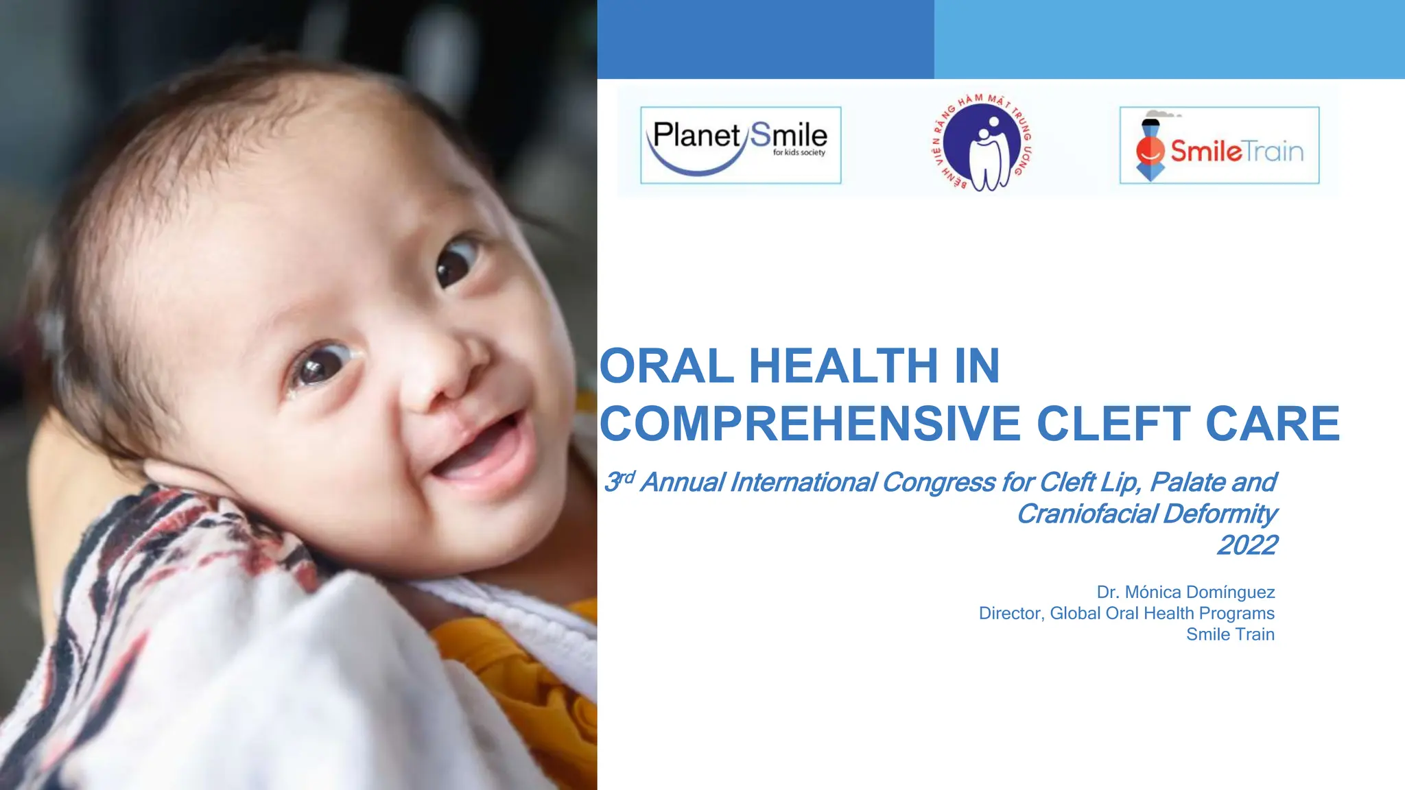 Oral Health for Children with Orofacial Clefts FDI GUIDELINES.pptx