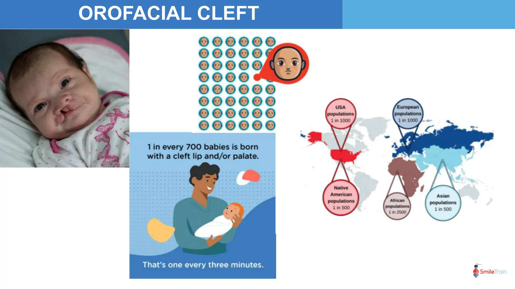 Oral Health for Children with Orofacial Clefts FDI GUIDELINES.pptx