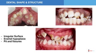 Oral Health for Children with Orofacial Clefts FDI GUIDELINES.pptx
