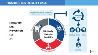Oral Health for Children with Orofacial Clefts FDI GUIDELINES.pptx
