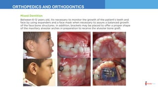 Oral Health for Children with Orofacial Clefts FDI GUIDELINES.pptx
