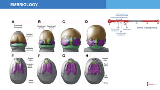 Oral Health for Children with Orofacial Clefts FDI GUIDELINES.pptx