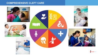 Oral Health for Children with Orofacial Clefts FDI GUIDELINES.pptx