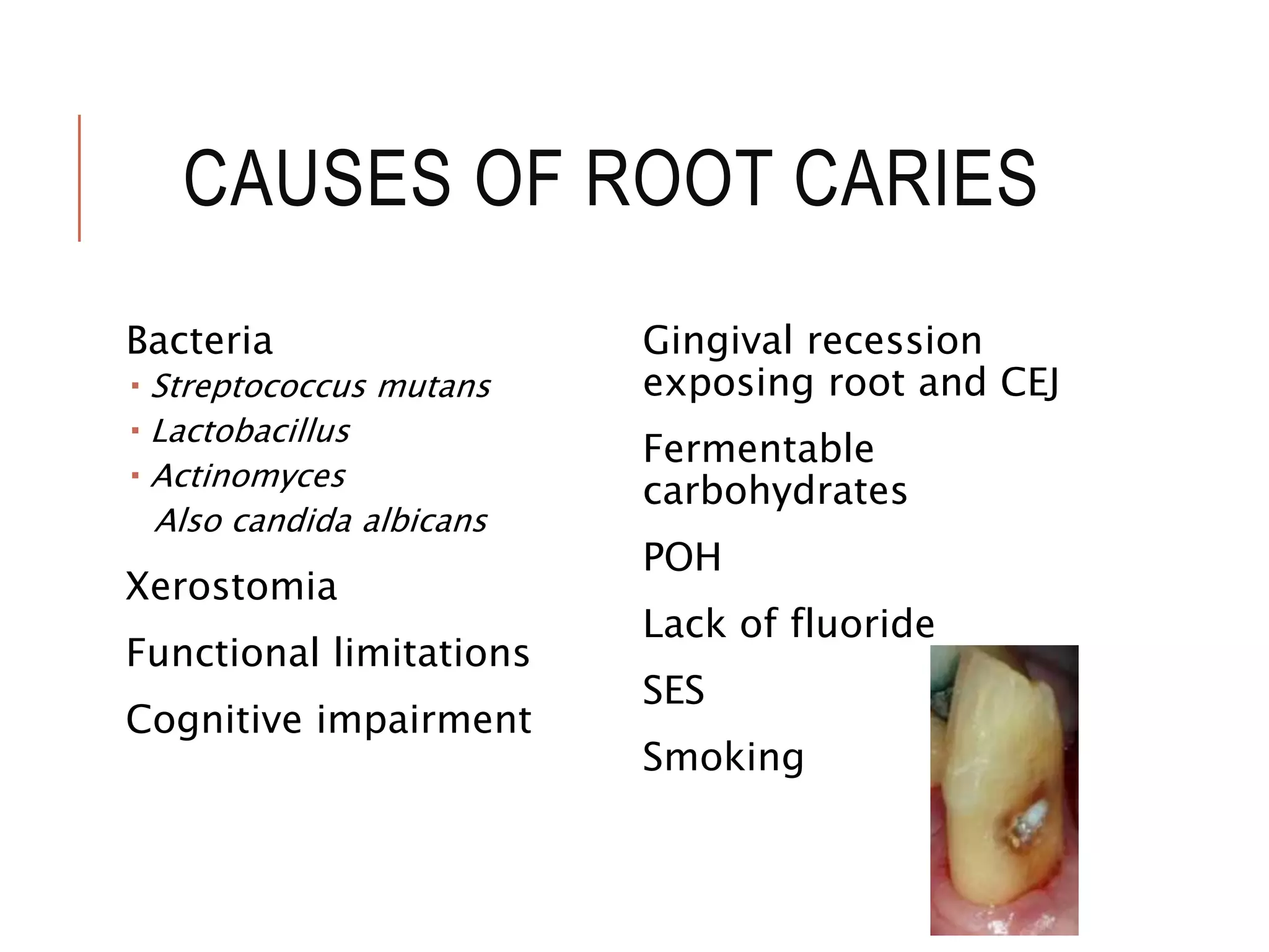 Oral Health for the Geriatric Population | PPTX