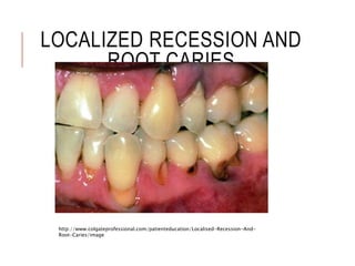 Oral Health for the Geriatric Population | PPTX