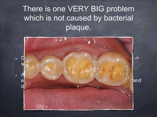 A quick guide to a healthy mouth | PPTX