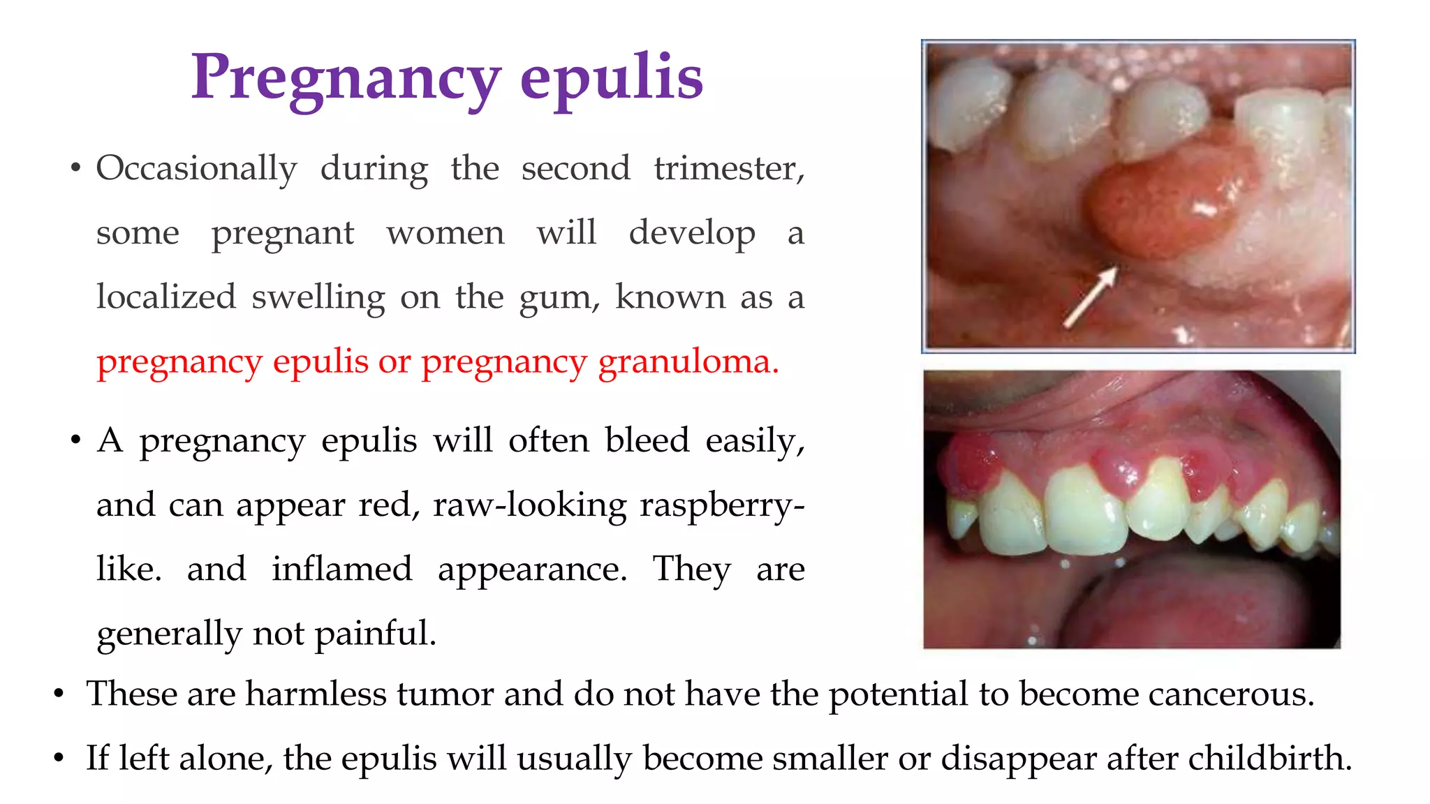 Oral health & Pregnancy.pptx