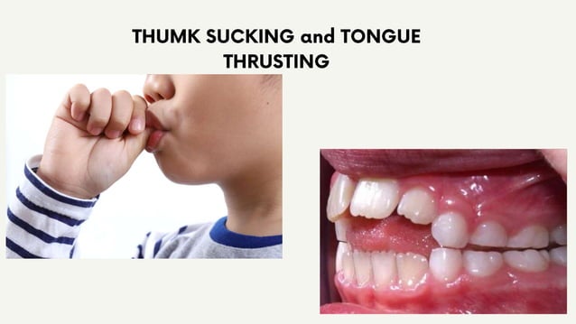 ORAL HEALTH TALK by Dr Tavleen Kaur .pptx