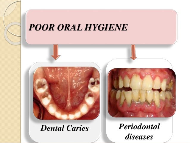 Poor Dental Hygiene