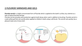 Oral hygiene | PPTX