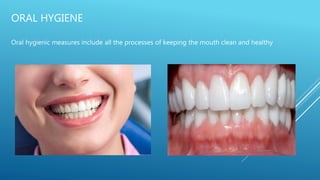 Oral hygiene instructions.pptx