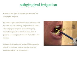 Oral irrigator | PPTX