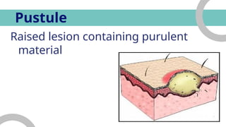 Oral lesions Description and Types .pptx
