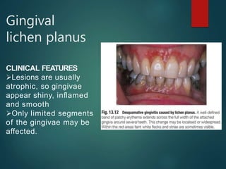 Erosive Lichen Planus Gingiva