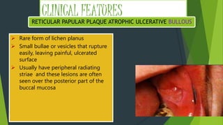 Oral lichen planus | PPTX