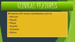 Oral lichen planus | PPTX