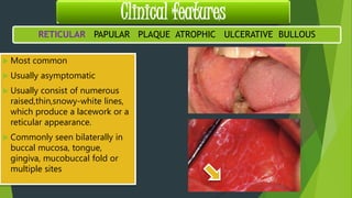 Oral lichen planus | PPTX