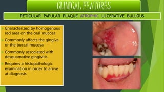 Oral lichen planus | PPTX