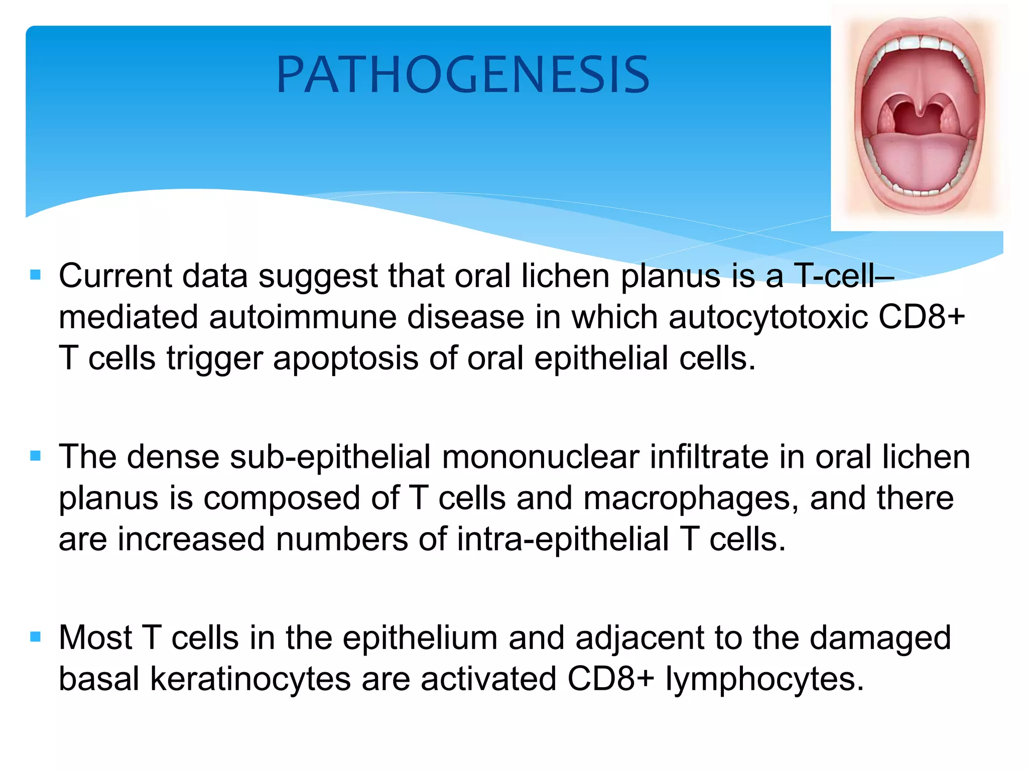 Oral lichen planus seminar | PPTX