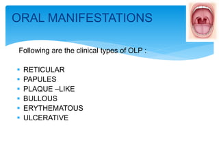 Oral lichen planus seminar | PPTX