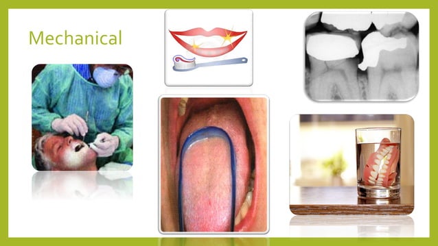 Oral malodor | PPT | Dental Health | Diseases and Conditions