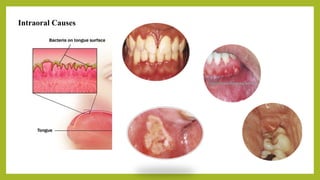 Oral malodor | PPT