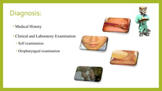 Oral malodor | PPT