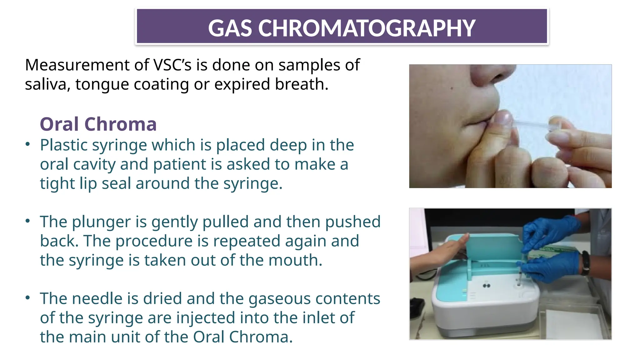 Oral Malodor.pptx zbznxjxjjsjsbbzhdhbxhxjjjx | PPT