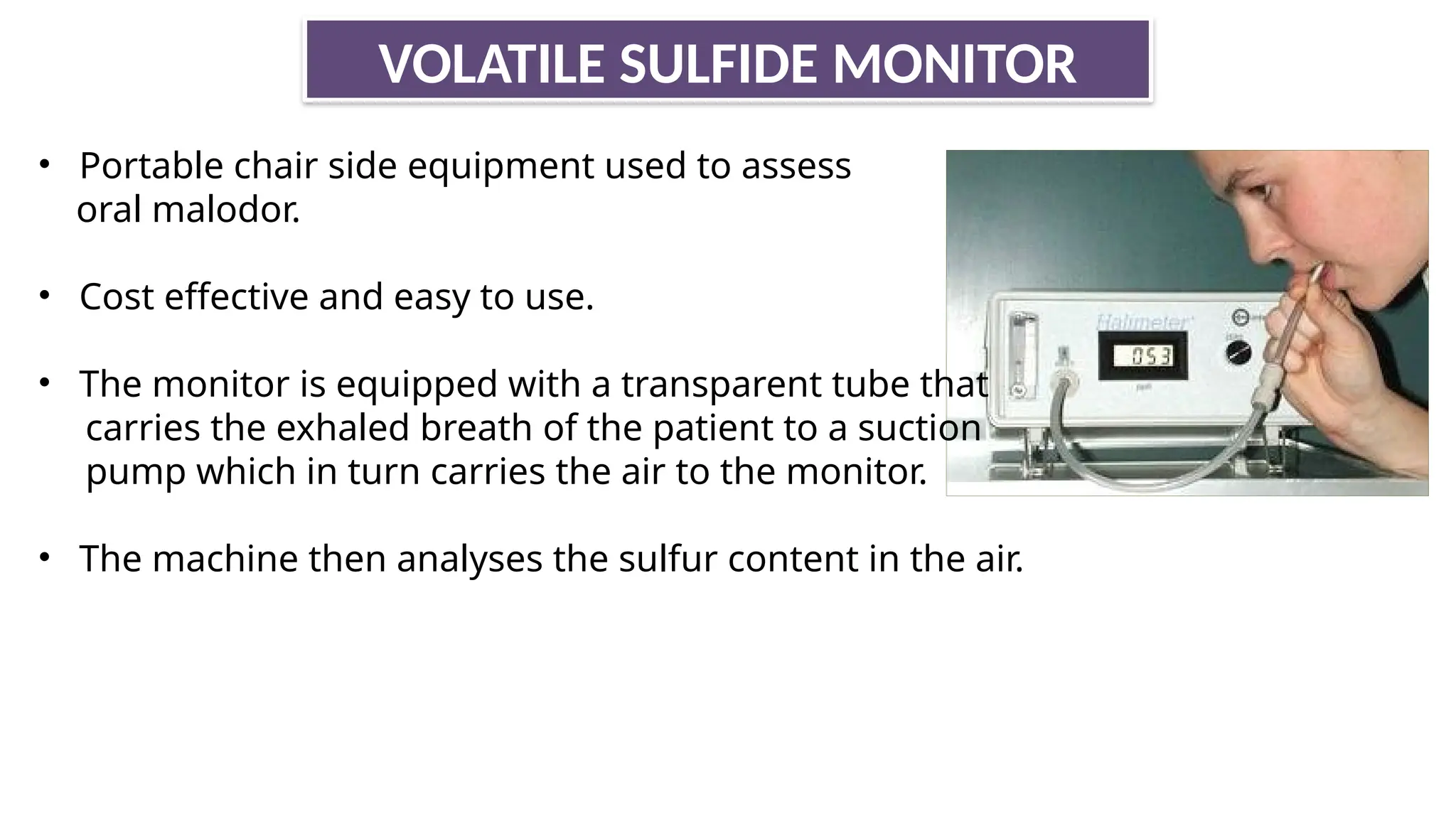 Oral Malodor.pptx zbznxjxjjsjsbbzhdhbxhxjjjx | PPT