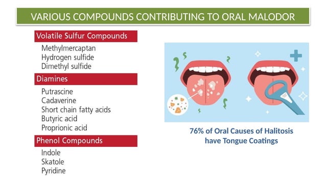 Oral Malodor.pptx zbznxjxjjsjsbbzhdhbxhxjjjx | PPT