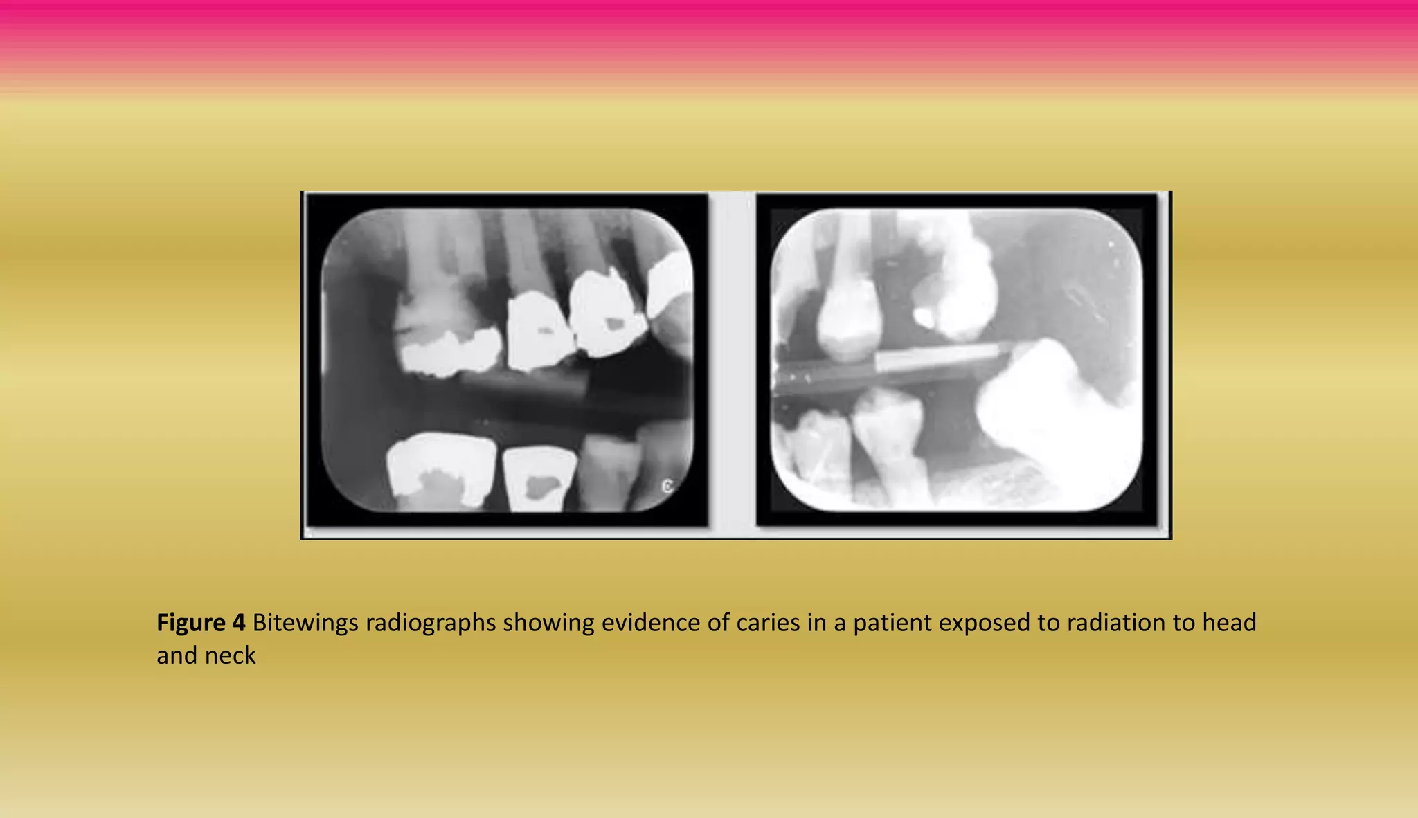 Oral management of cancer patients.pptx
