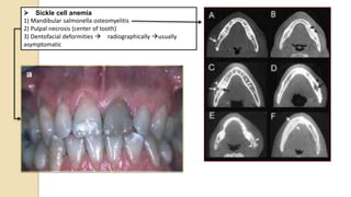 Oral manf of systemic disease | PPTX