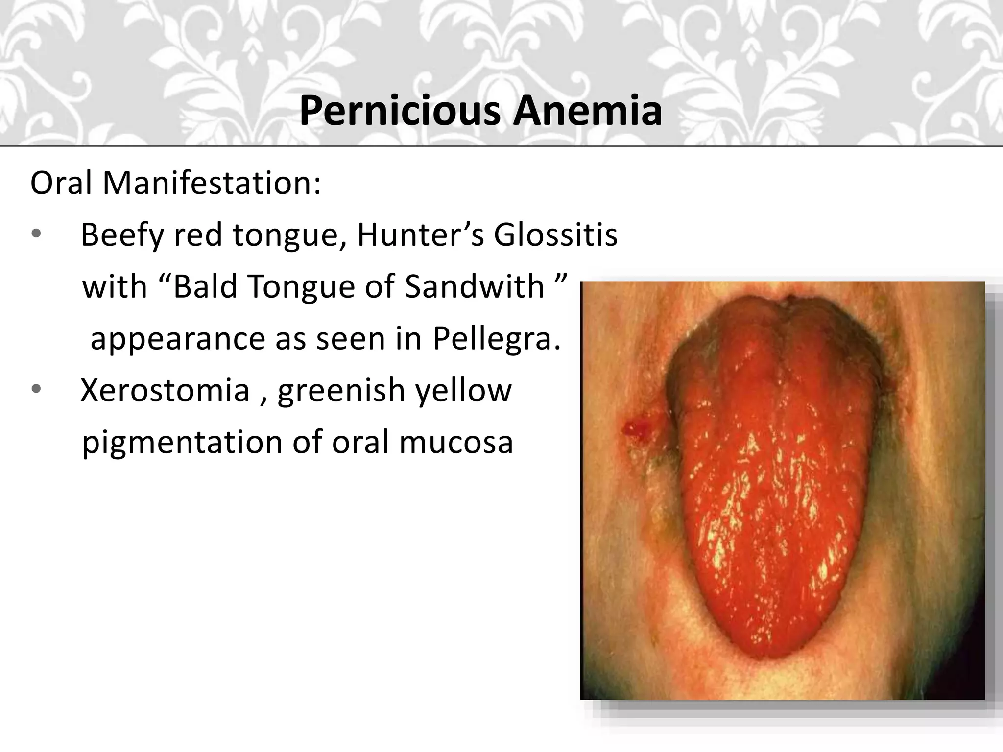 Oral manifestation of bleeding disorders | PPTX