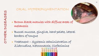 Oral Manifestations of HIV | PPTX