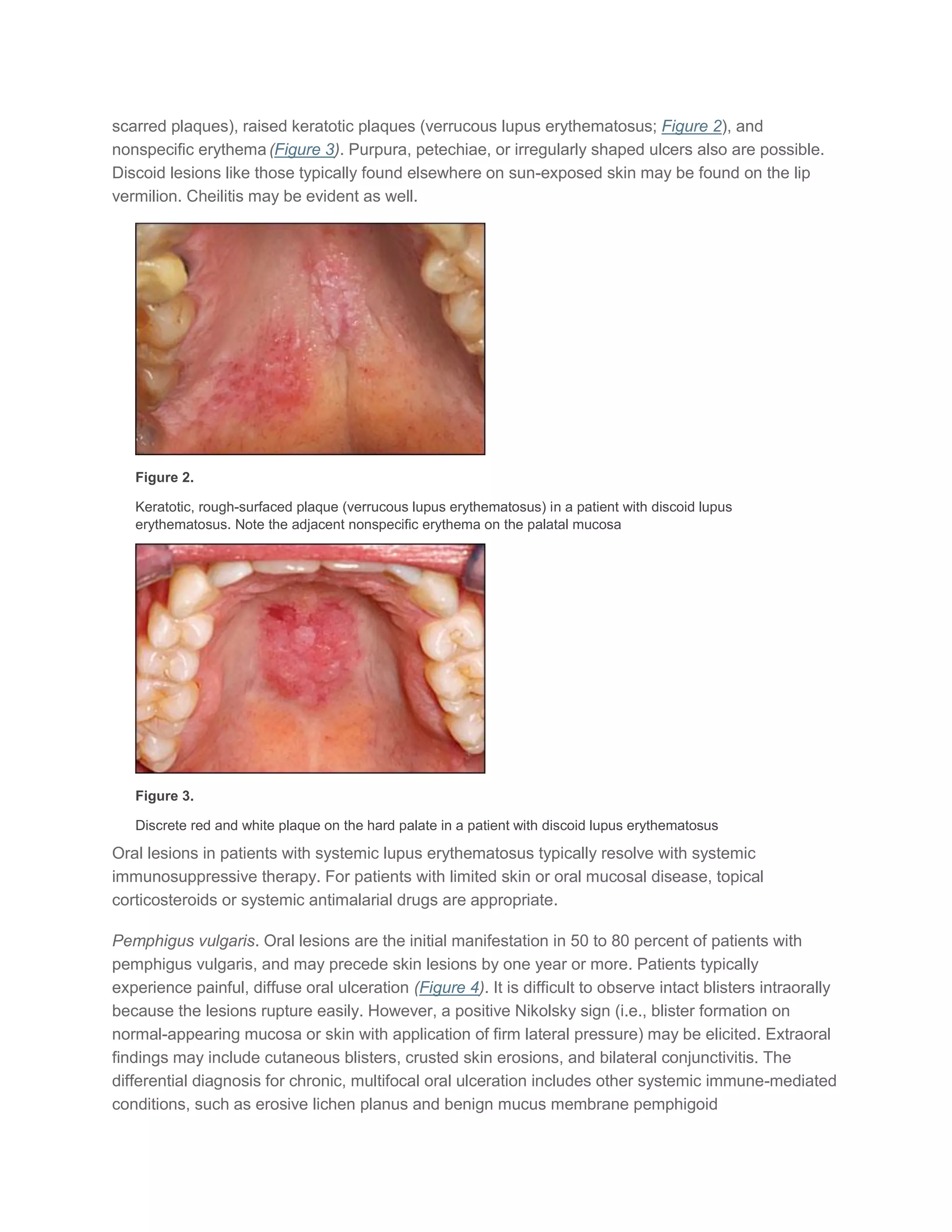 Oral manifestation of systemic disease | PDF