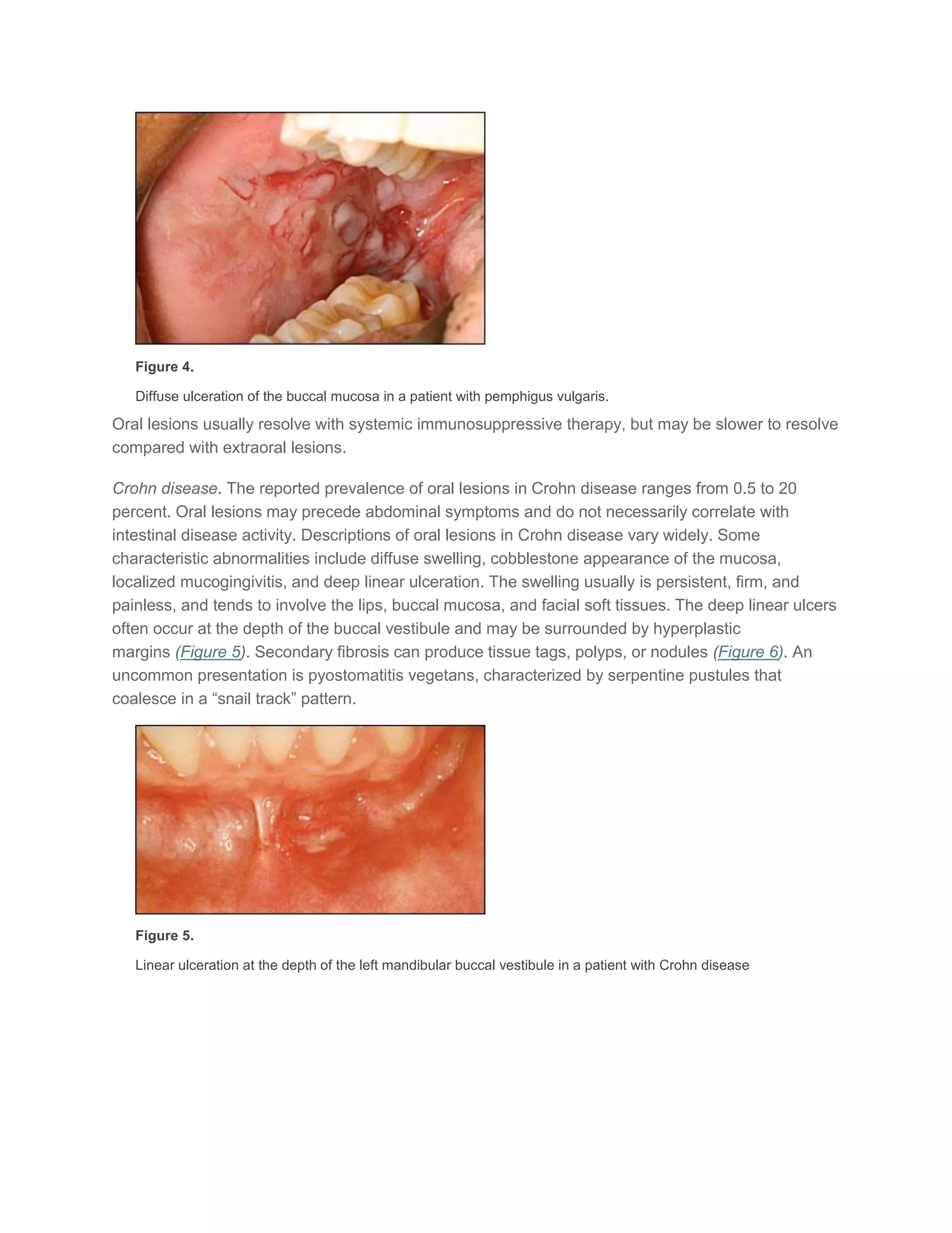 Oral manifestation of systemic disease | PDF