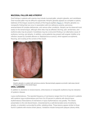Oral manifestation of systemic disease | PDF