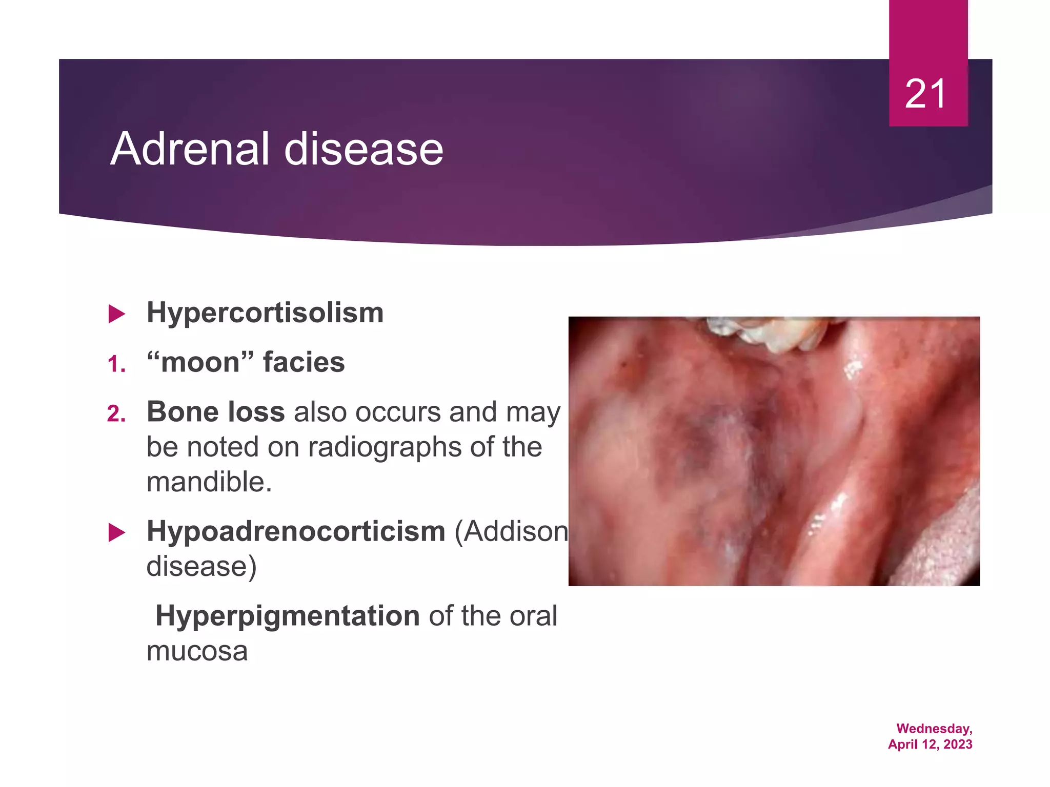 oral manifestation of systemic diseases.ppt