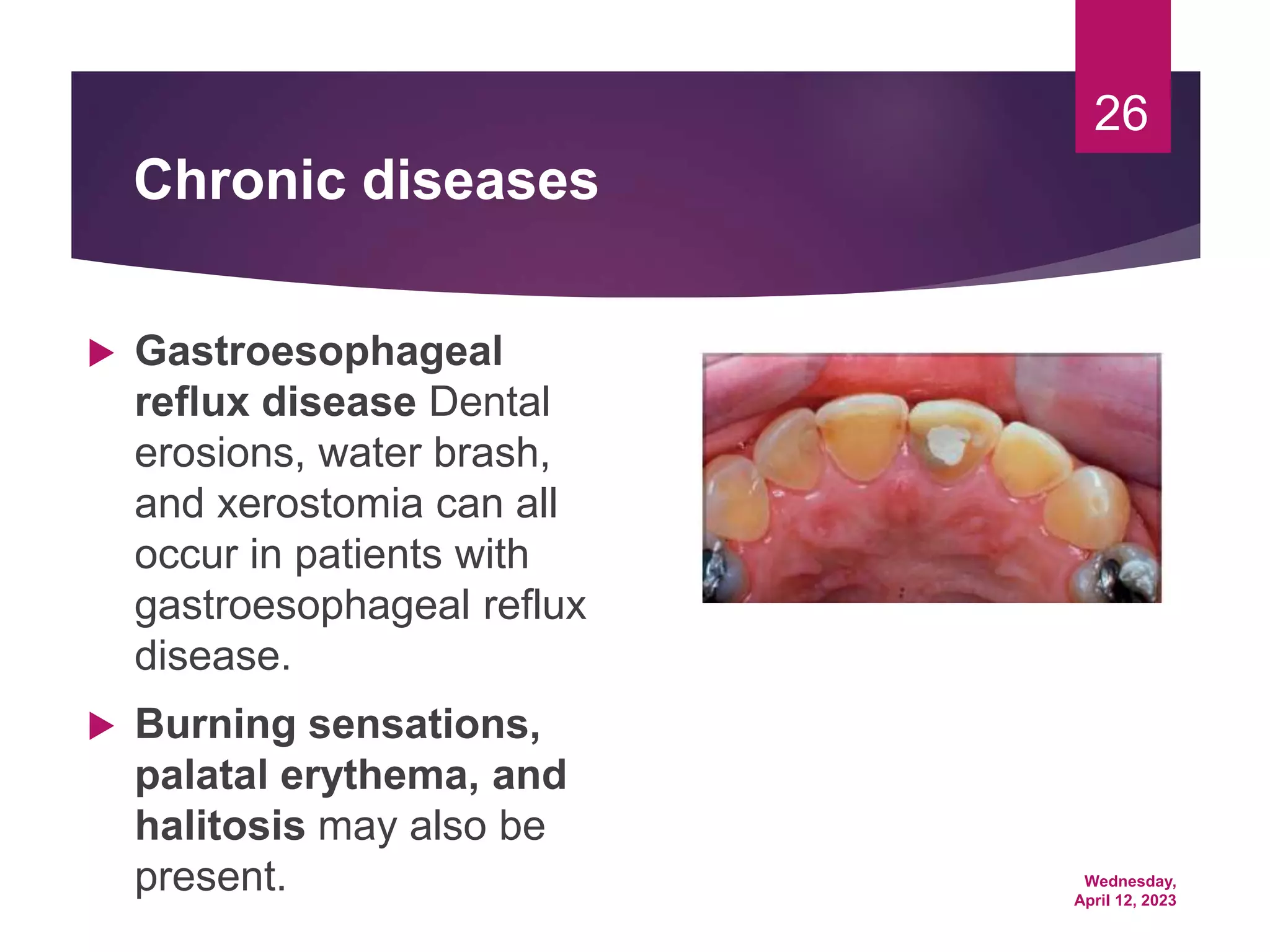 oral manifestation of systemic diseases.ppt