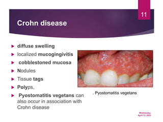 oral manifestation of systemic diseases.ppt
