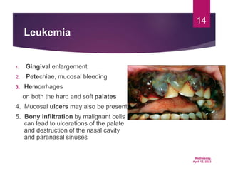 oral manifestation of systemic diseases.ppt