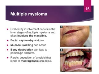 oral manifestation of systemic diseases.ppt