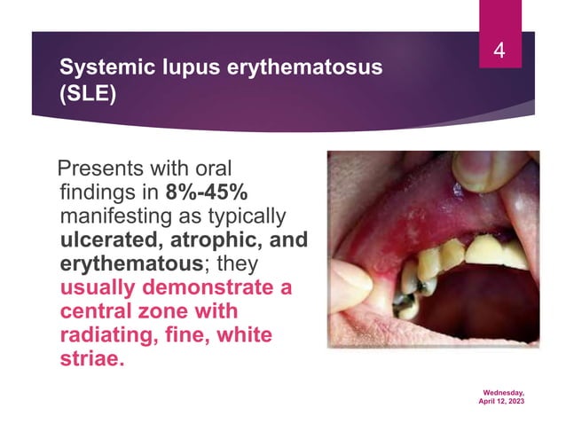 oral manifestation of systemic diseases.ppt