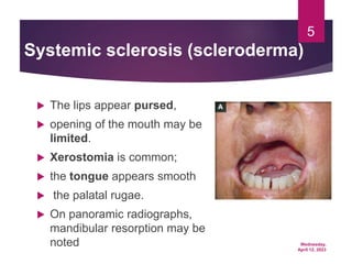 oral manifestation of systemic diseases.ppt