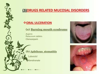 Oral manifestations of drug reactions & treatment | PPTX